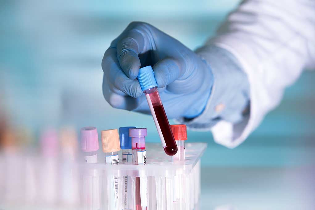 Unveiling DARPA’s Revolutionary Red Blood Cell Innovations for Military ...